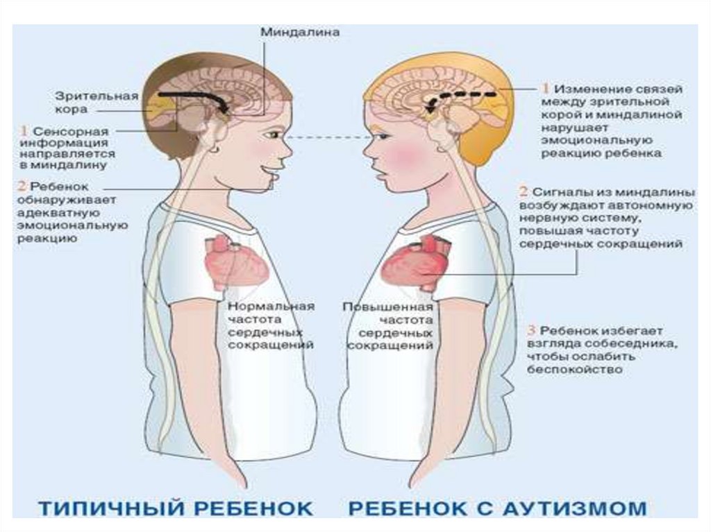 Коррекционно–педагогическое сопровождение детей с расстройствами ...