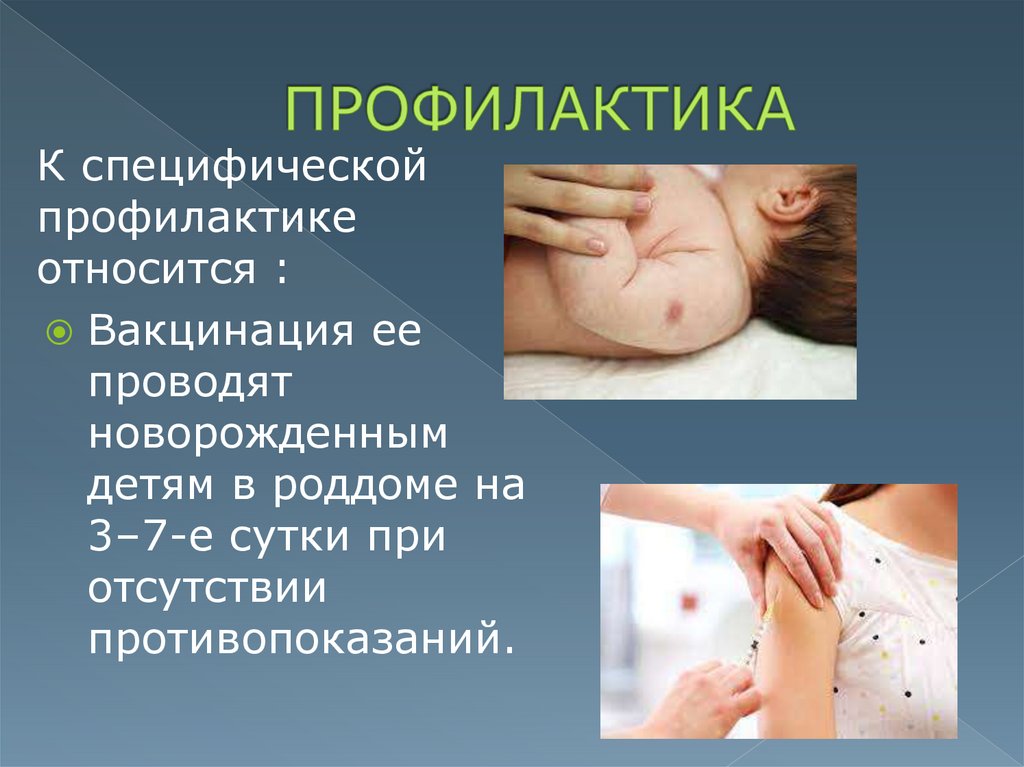 Туберкулез презентация онлайн