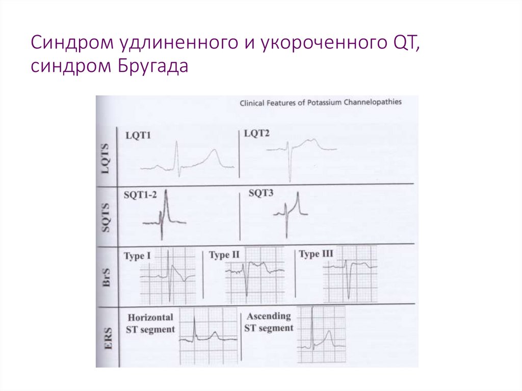 Нарушения ритма и проводимости. Тема №4 - презентация онлайн