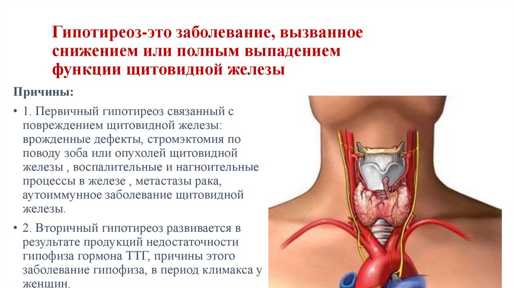 Сестринская помощь при заболеваниях щитовидной железы - презентация онлайн