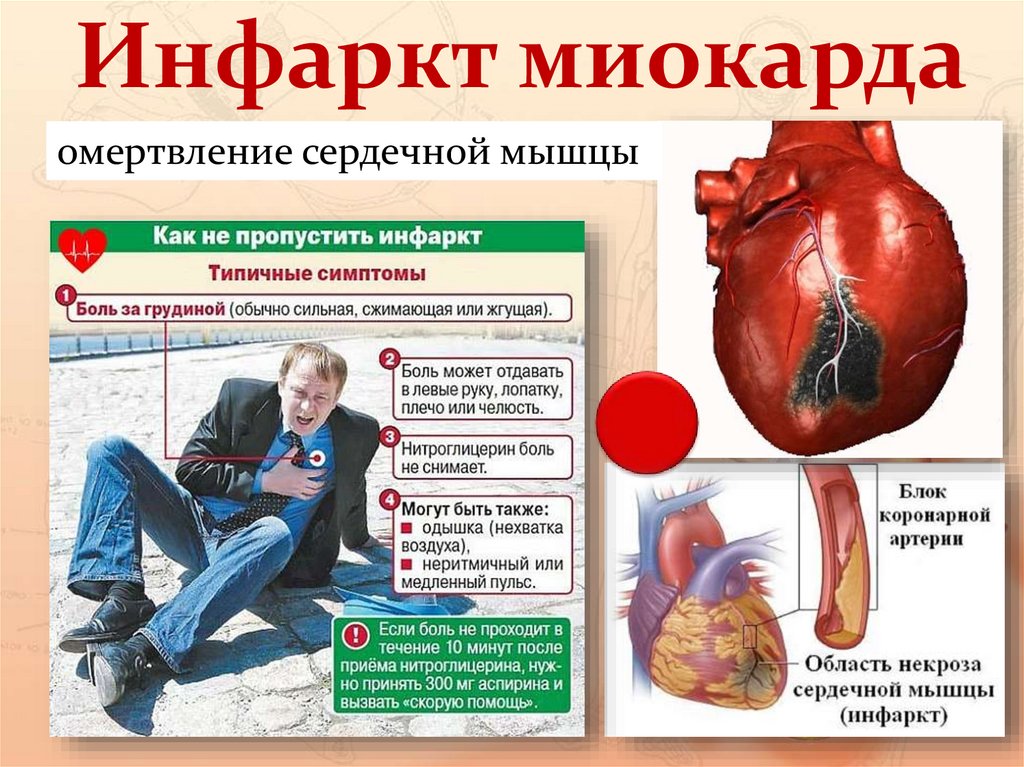 Профилактика нарушения деятельности сердечно-сосудистой системы ...