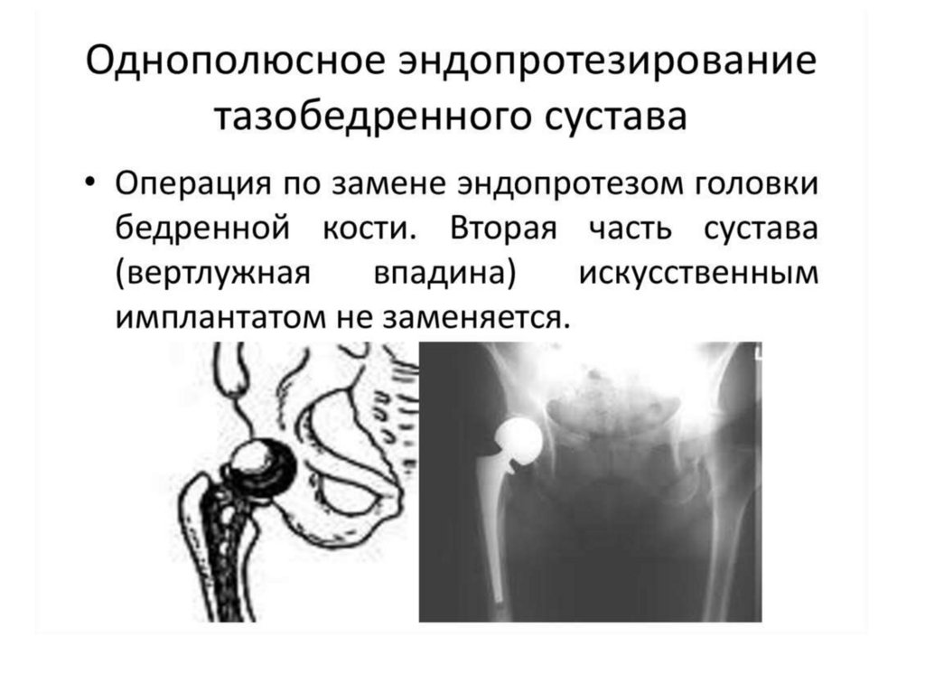 Эндоскопическая хирургия нижних конечностей - презентация онлайн