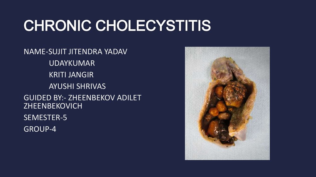 Chronic Cholecystitis презентация онлайн