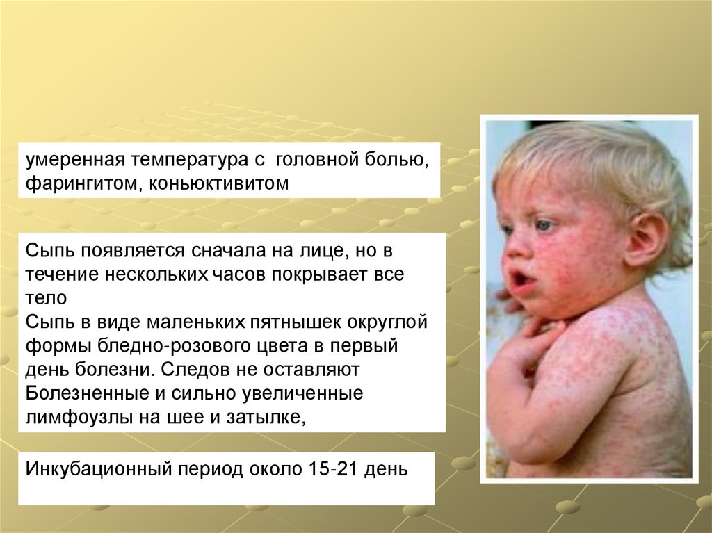 Инфекционные заболевания у детей презентация онлайн