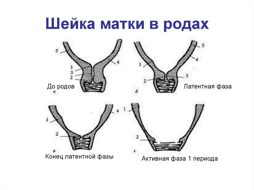 Естественные роды (лекция 1) - презентация онлайн