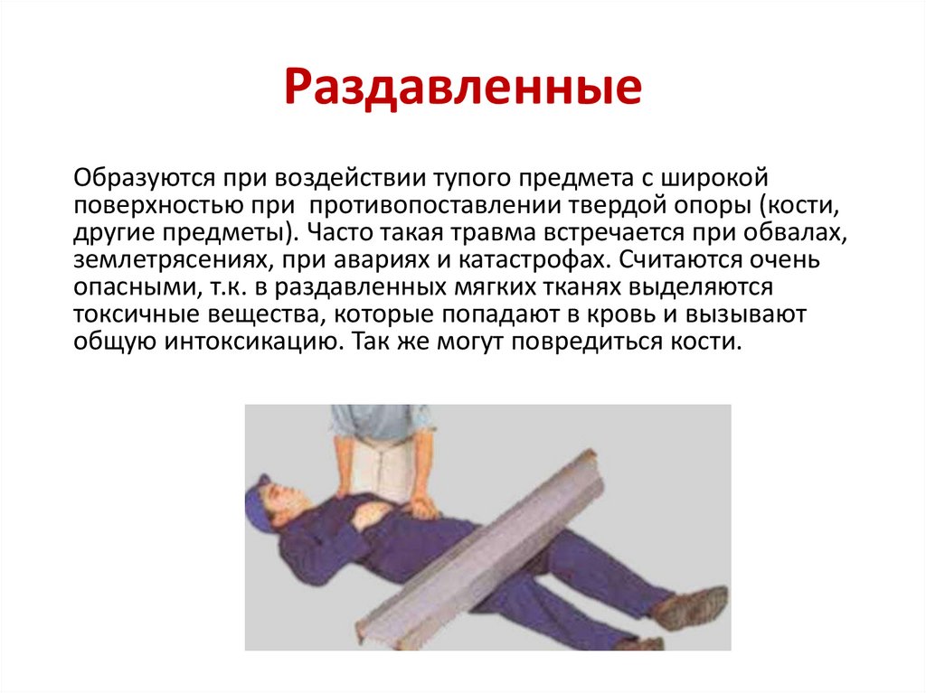 Механические травмы - презентация онлайн