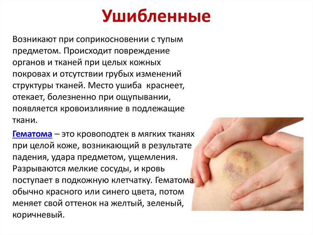 Механические травмы - презентация онлайн