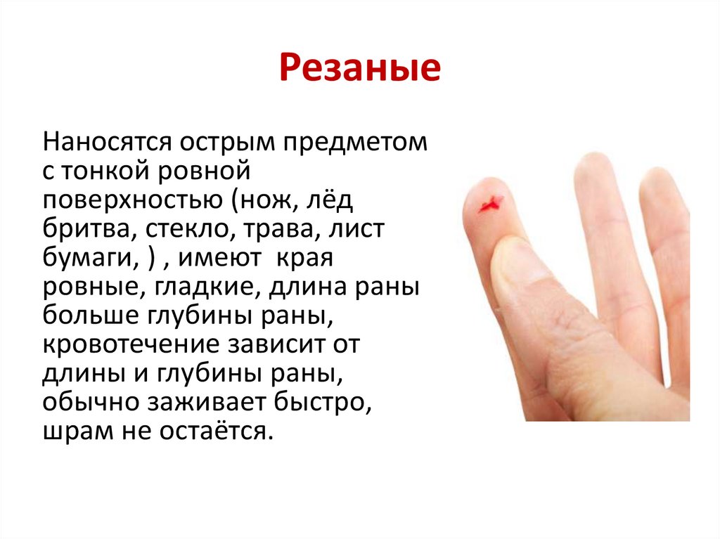 Механические травмы - презентация онлайн