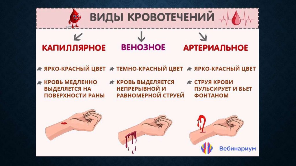 Первая помощь при кровотечениях и ранениях - презентация онлайн